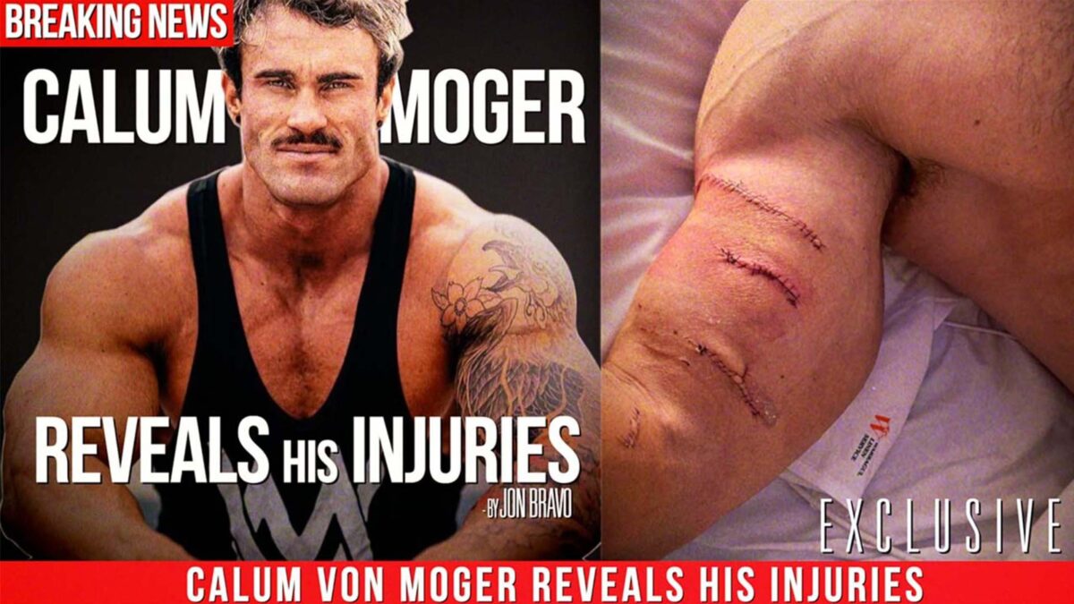 Calum Von Moger Finally Reveals His Injuries! – IronMag Bodybuilding ...
