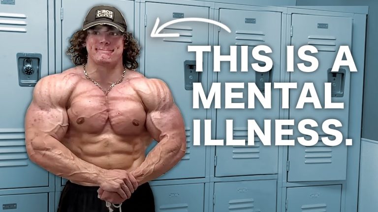 Sam Sulek Going BALD From STEROID Abuse? – IronMag Bodybuilding & Fitness Blog