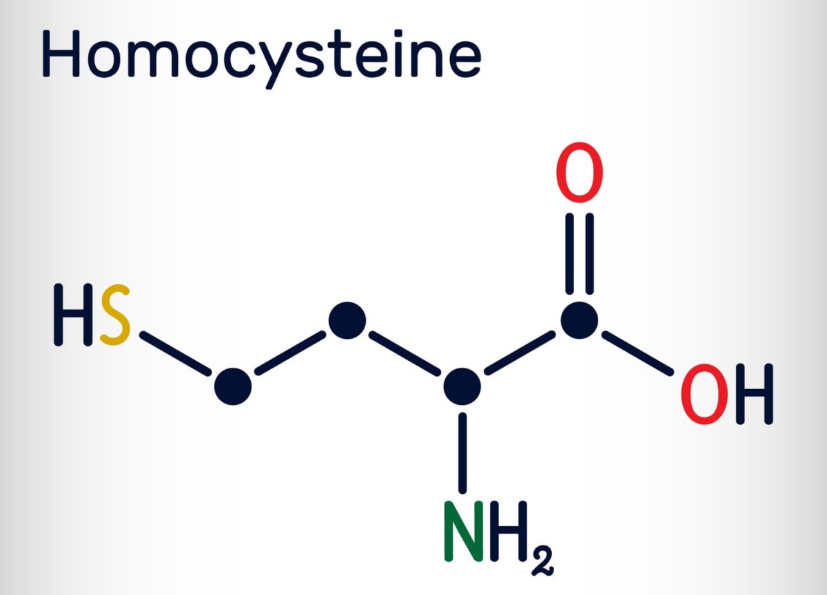 Should You Worry About Your Homocysteine Levels? – IronMag Bodybuilding ...